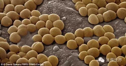 显微镜告诉你手上细菌到底张啥样！_手机凤凰网